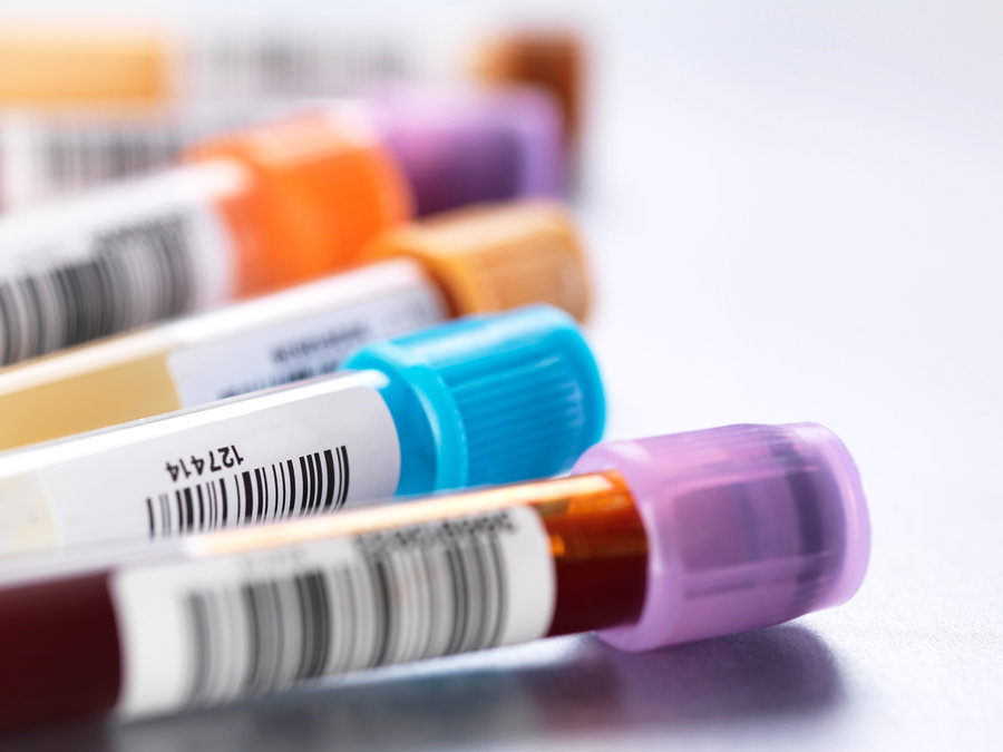 Serology Testing for Deceased Organ Donors | The Organ Donation and ...