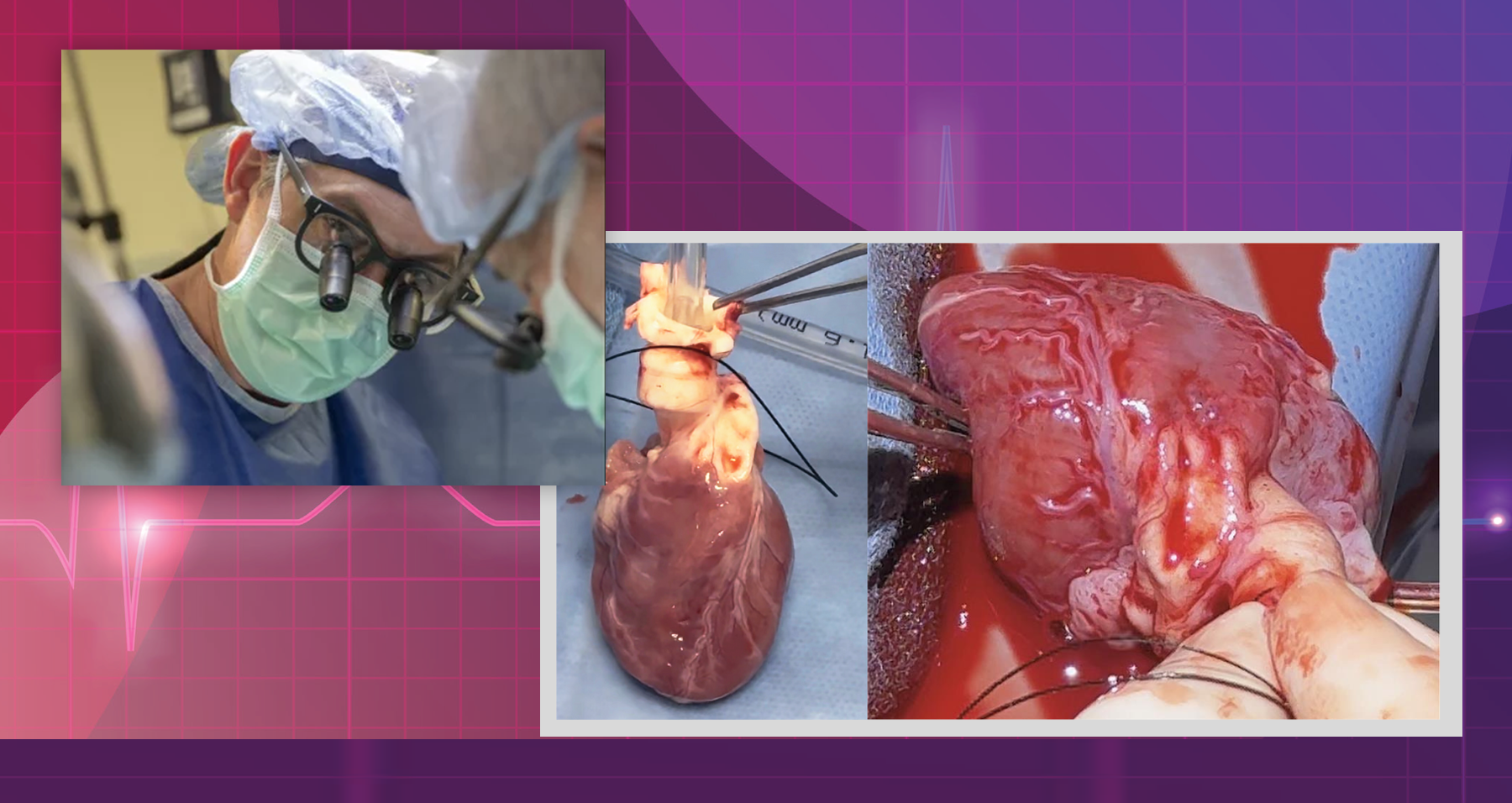 Following Alliance Learning Program, Duke Children’s Team Published in ...